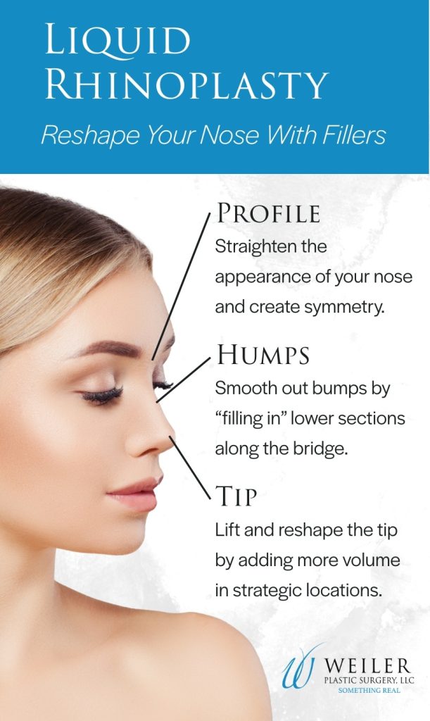 Infographic: Nonsurgically Reshape Your Nose With Liquid Rhinoplasty ...