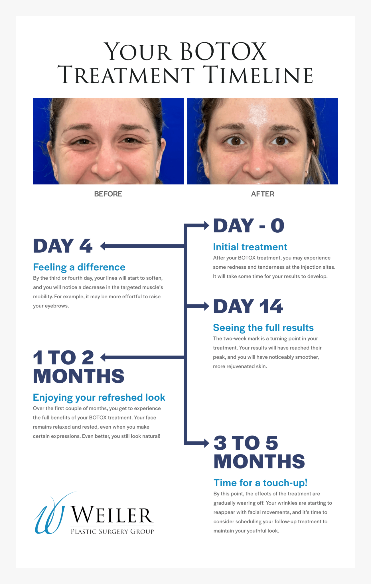 How Long Does BOTOX® Last? – Weiler Plastic Surgery Group